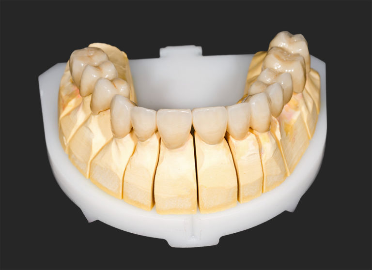 Protetika | Dentalna medicina Rogoznica